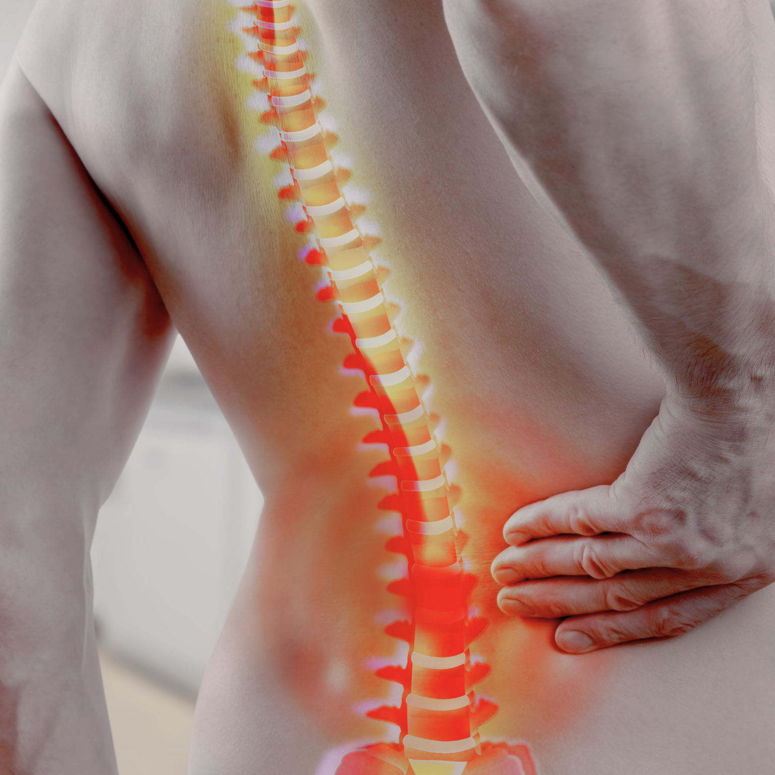 Spondylolisthesis Treatment in Wisconsin | Non-Surgical Relief